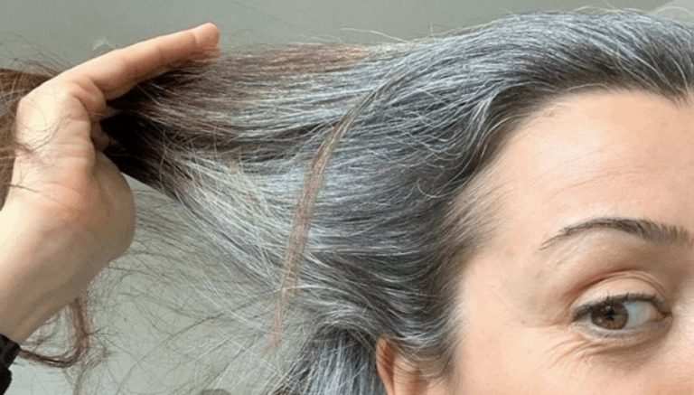 ¿Por qué se producen la canas y cómo evitarlas? - El Clarin